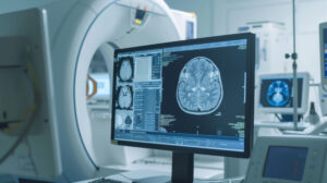 Innovations in Medical Imaging: Advancements That Improve Patient Care