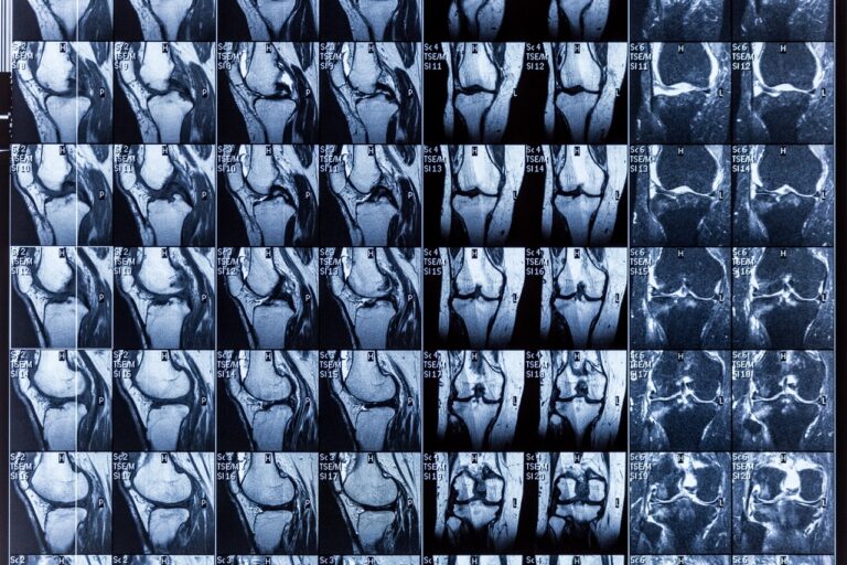 Essential MRI Clothing Safety Guidelines - Precision MRI Group